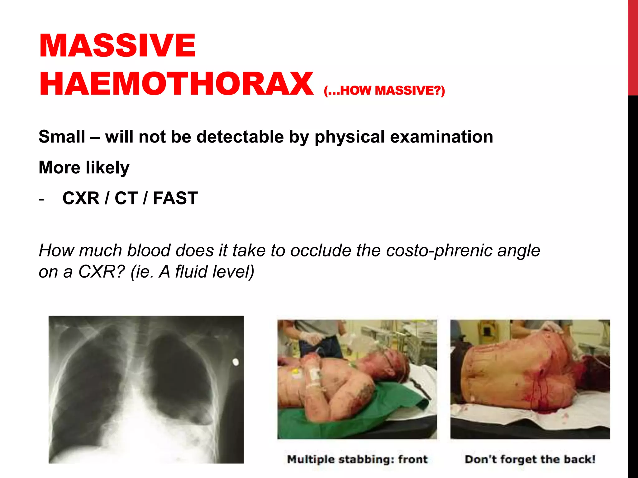 Thoracic trauma presentation | PPTX