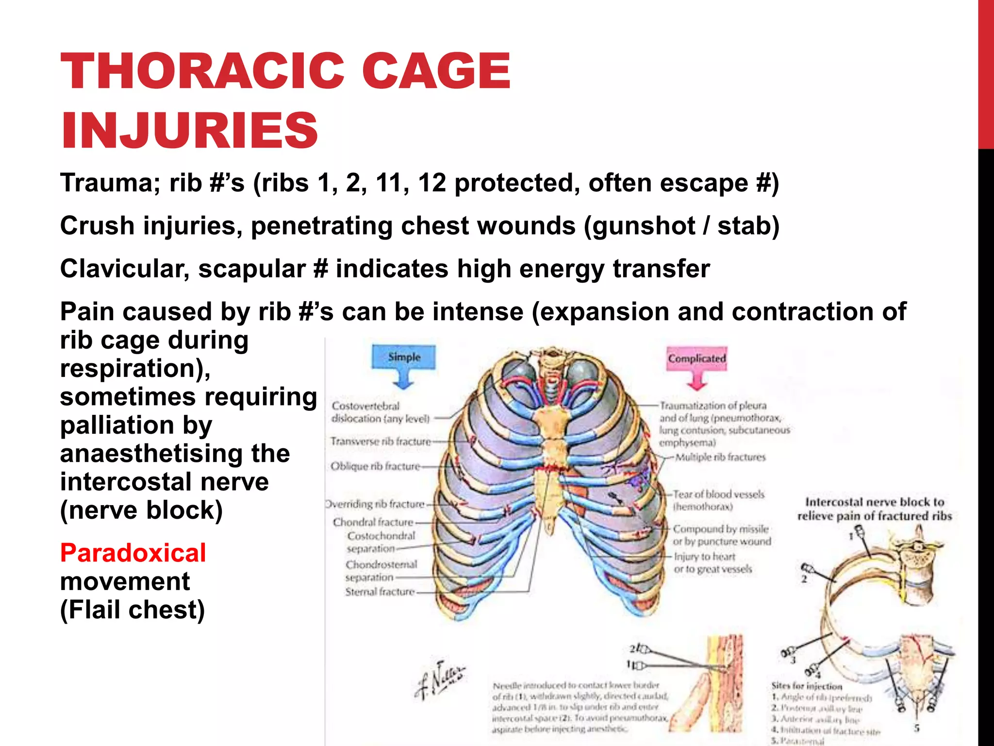 Thoracic trauma presentation | PPTX