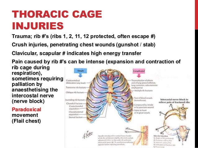 Thoracic trauma presentation