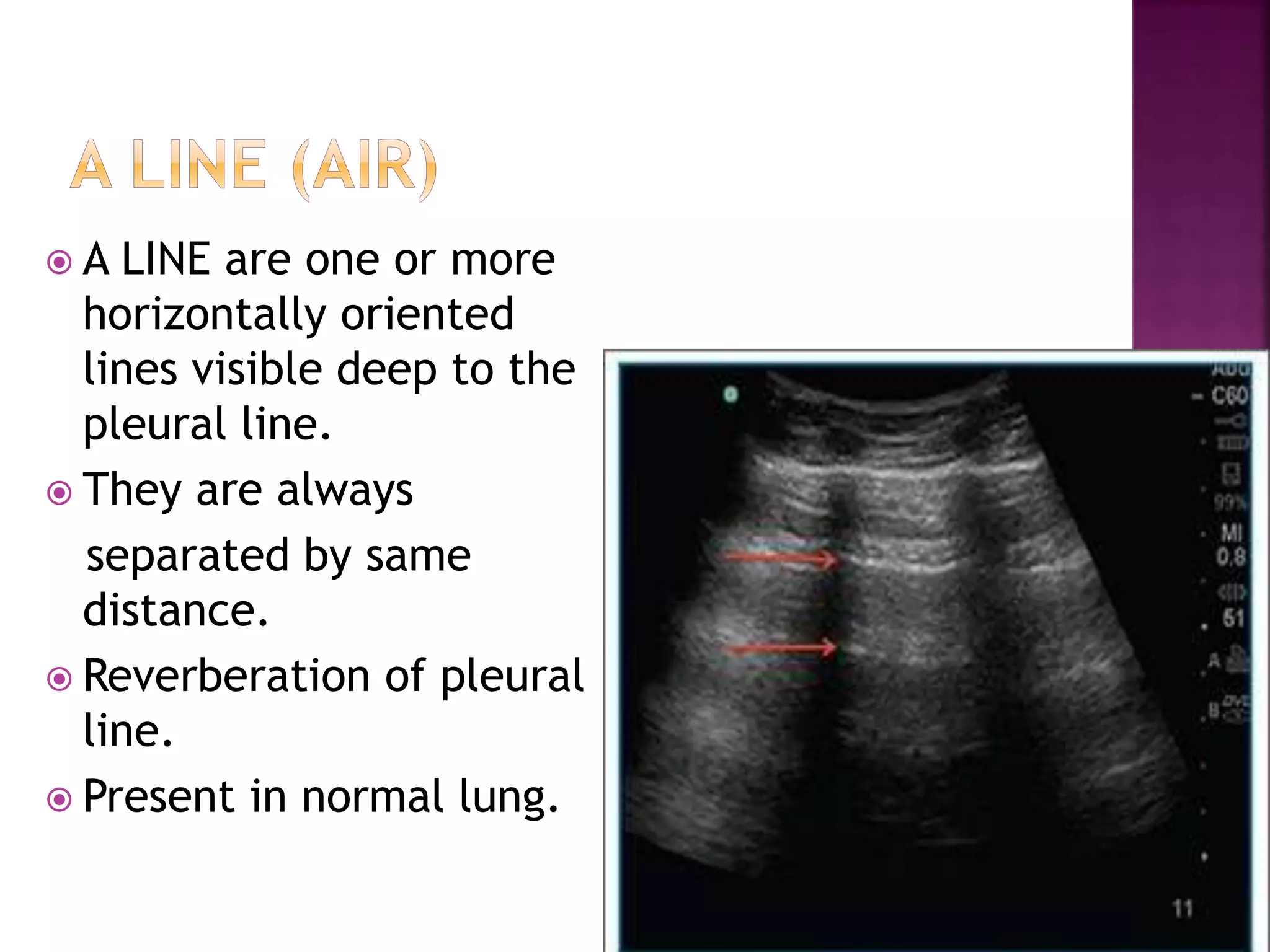 Thoracic ultrasonography ULTIMATE | PPTX