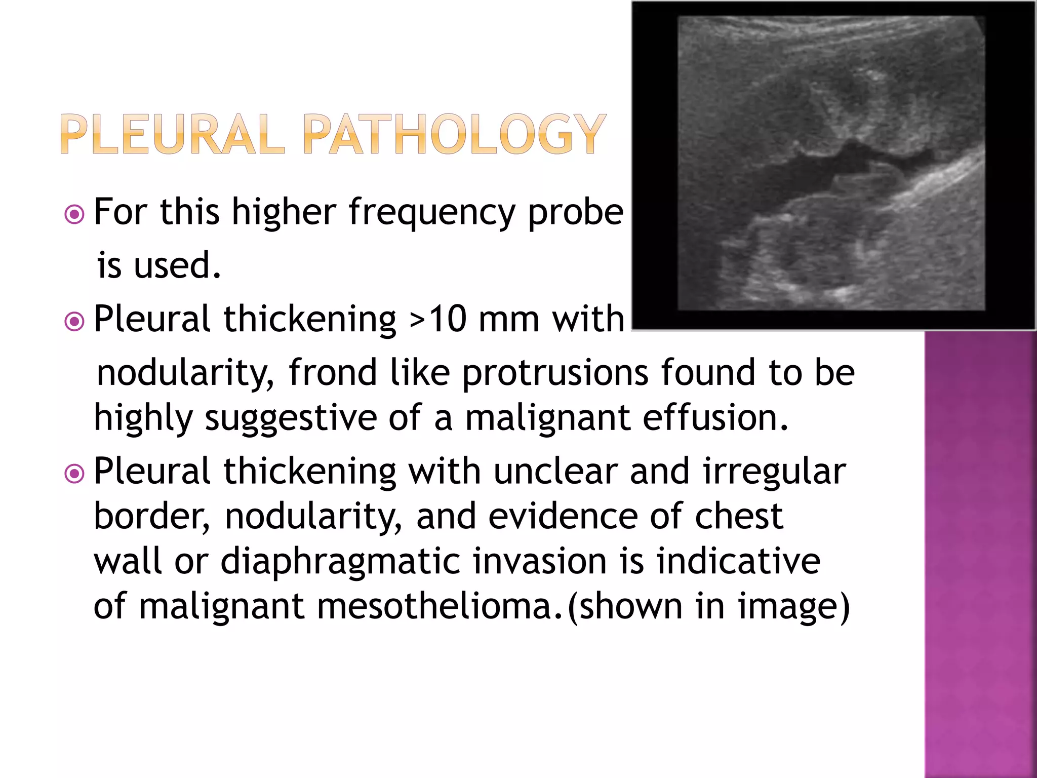 Thoracic ultrasonography ULTIMATE | PPTX