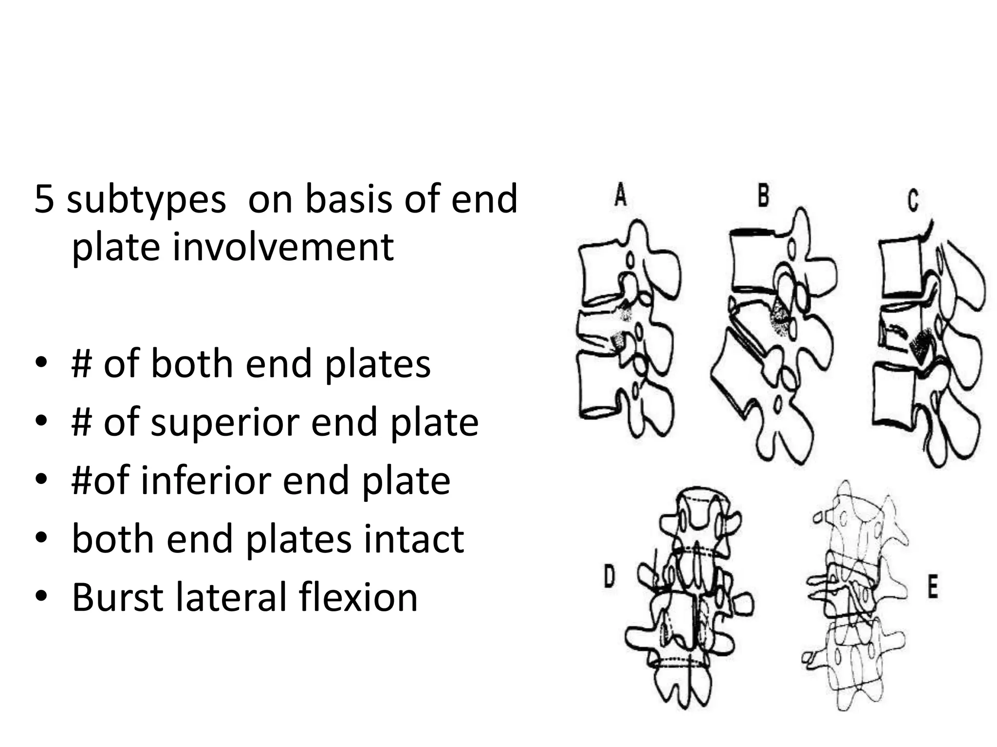 Thoraco lumbar fractures of spine | PPTX