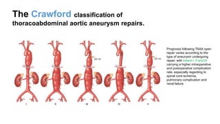 Thoraco Abdominal Aortic Aneurysm technique for present ok.pptx
