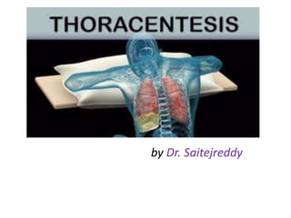 Thoracentesis Position
