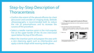 Thoracocentesis or Thoracentesis or Chest Tube.pptx | Lung and ...