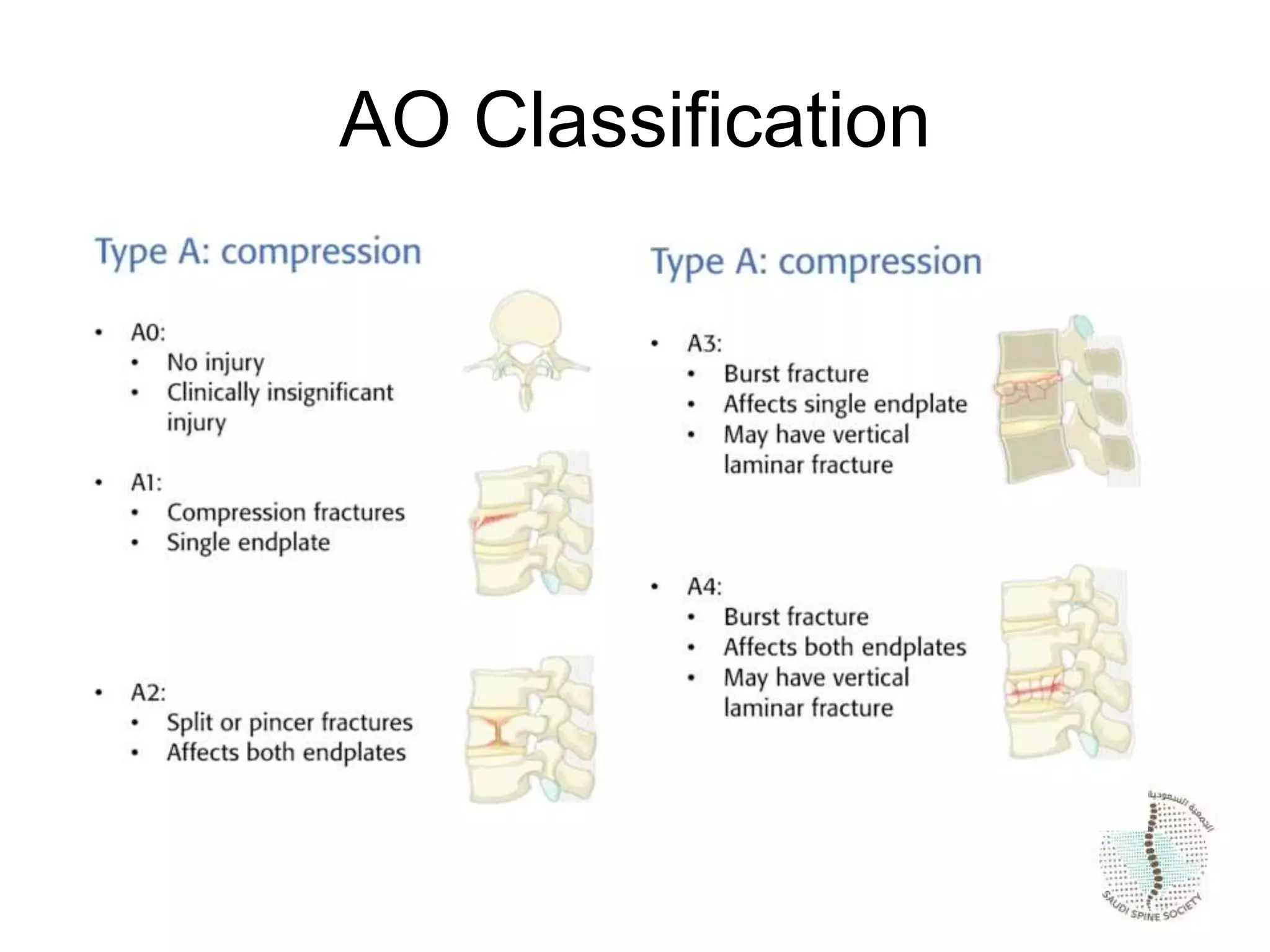 Thoracolumbar-spine-fracture-.ppt