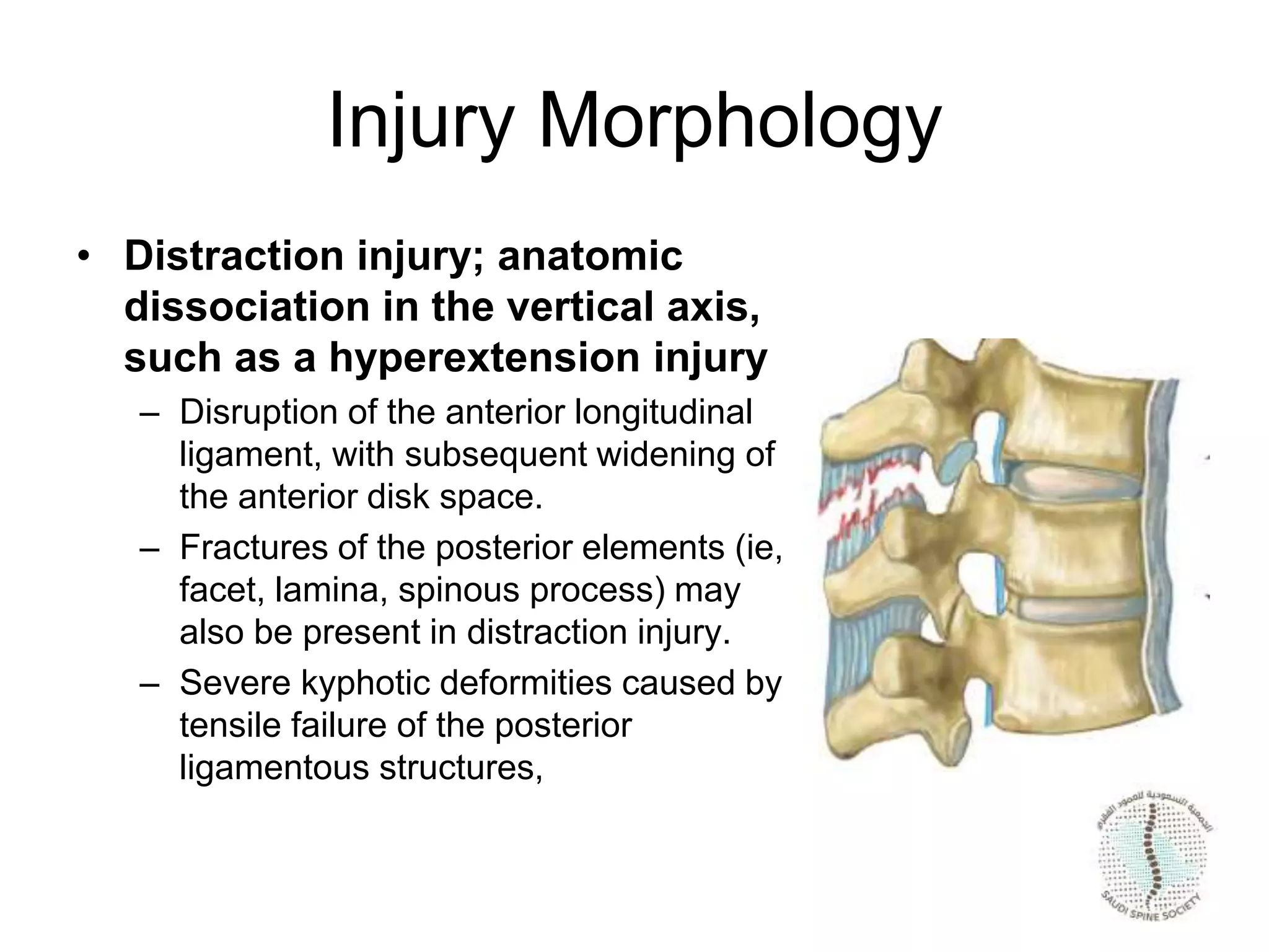 Thoracolumbar-spine-fracture-.ppt