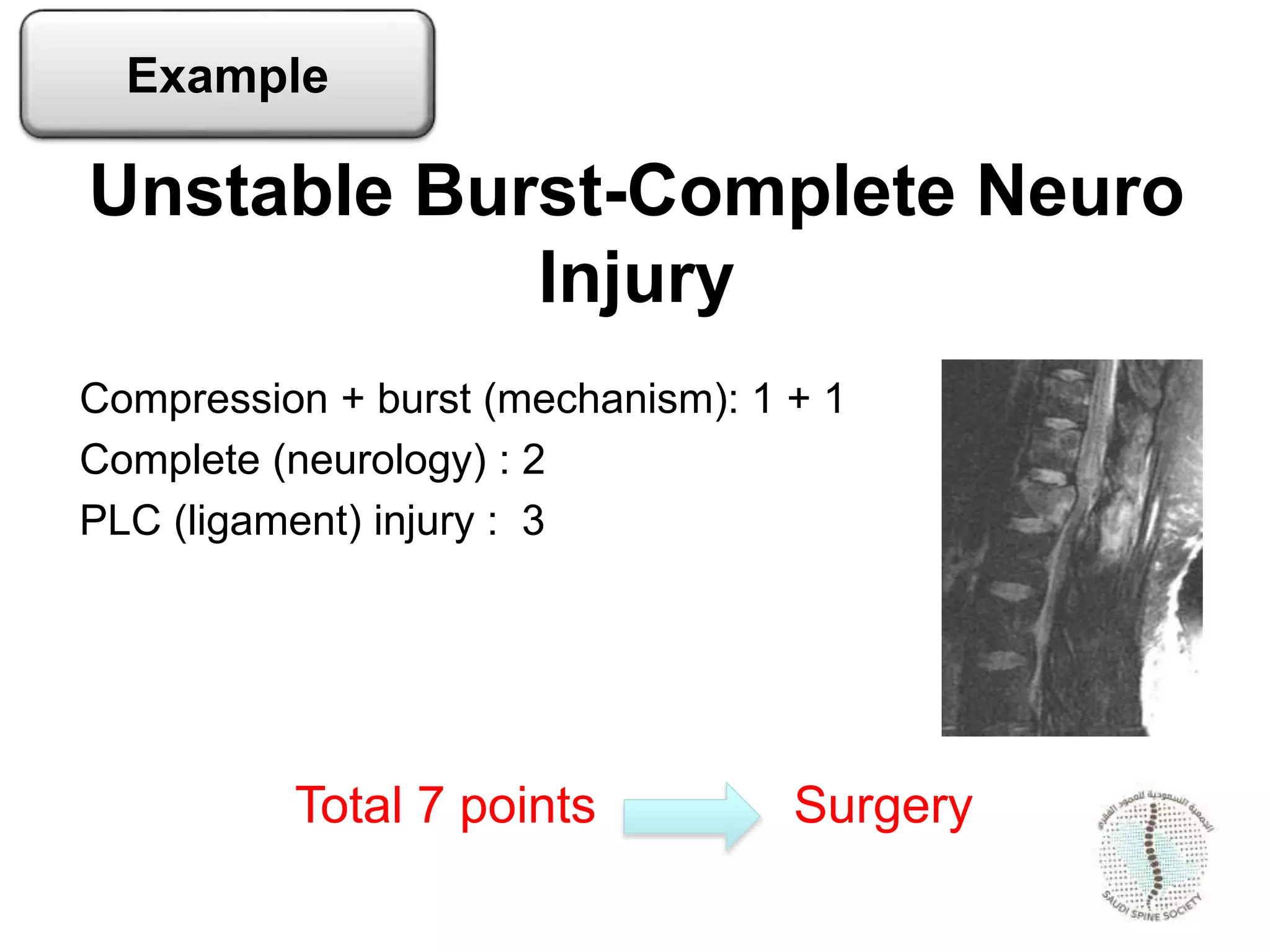 Thoracolumbar-spine-fracture-.ppt