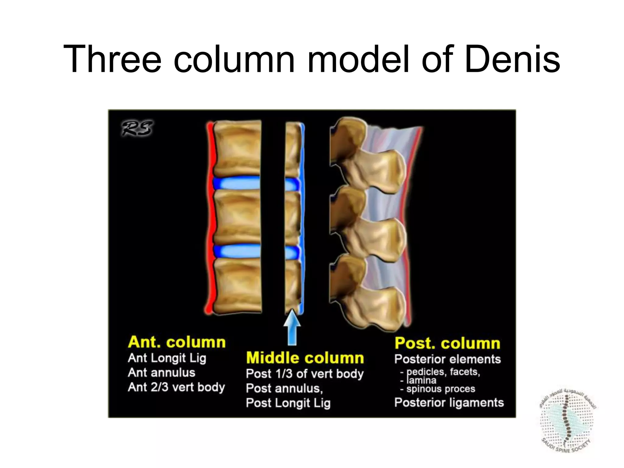 Thoracolumbar-spine-fracture-.ppt