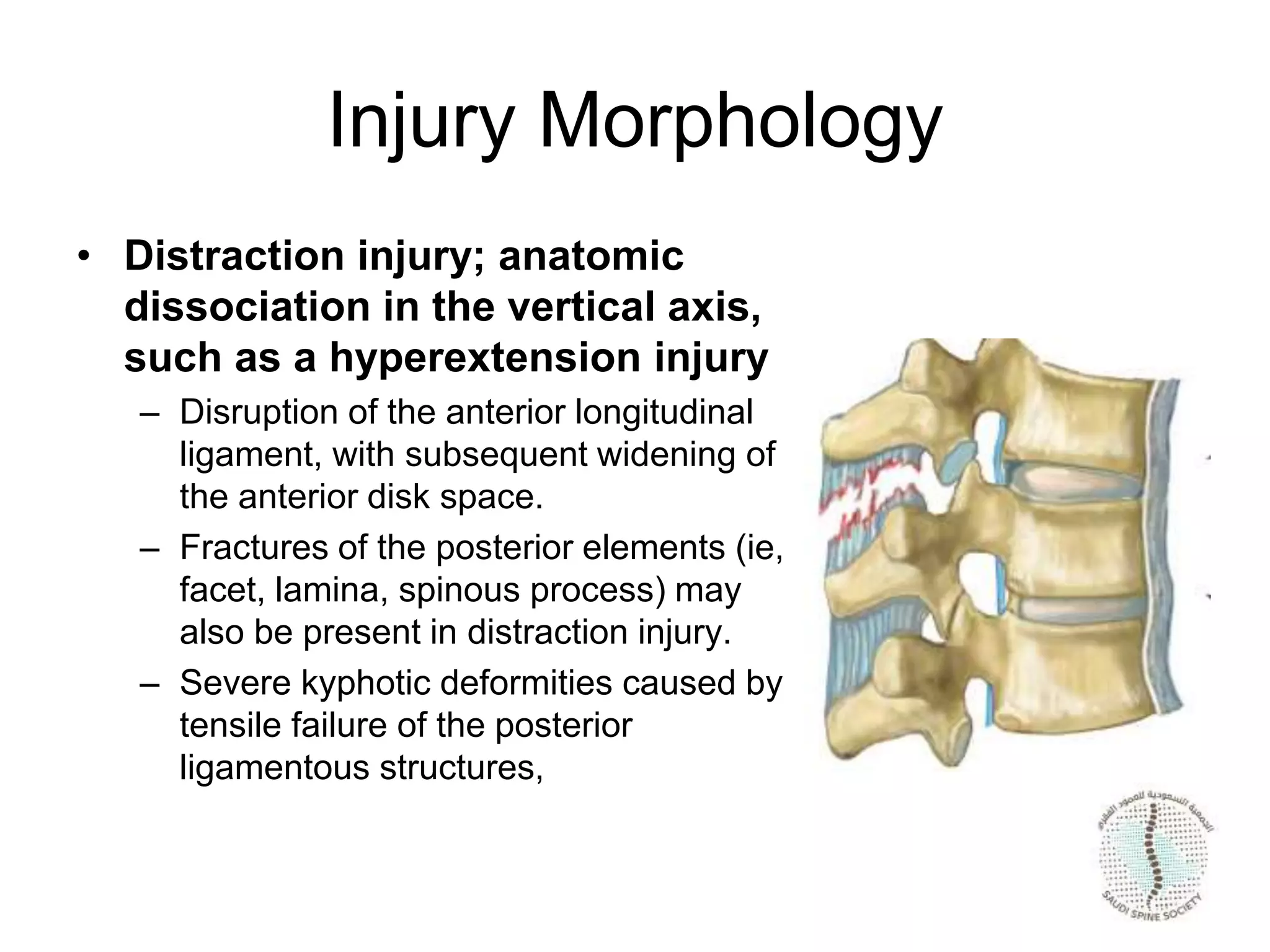Thoracolumbar-spine-fracture-.ppt