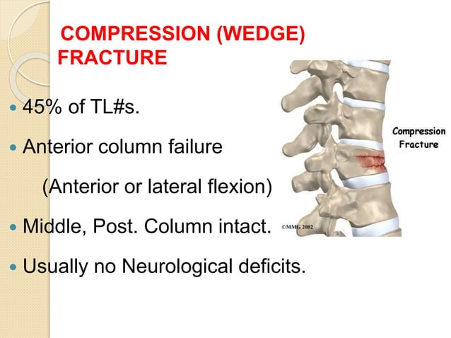 Thoracolumbar fracture cme | PPTX | Death, Injury, or Military Conflict ...