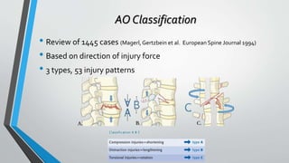 Thoracolumbar fractures classification | PPTX