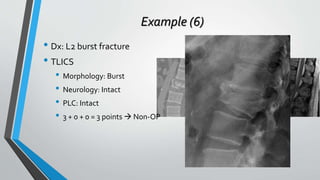 Thoracolumbar fractures classification | PPTX