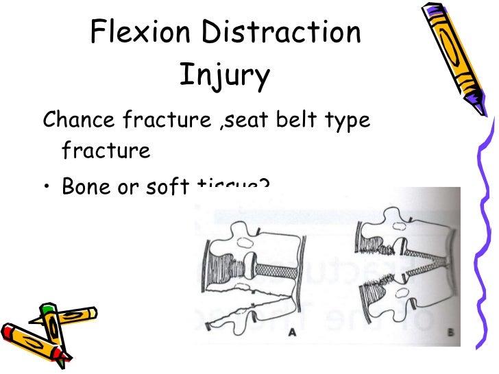 Thoraco lumbar injuries
