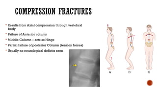 Thoracolumbar injuries and fractures…….. | PPTX