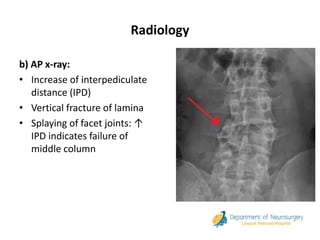 Thoracolumber fractures | PPTX
