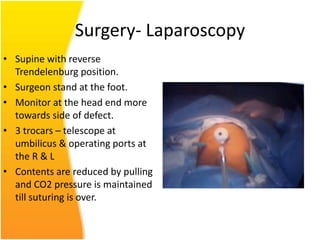 Thoracoscopy vs laparoscopy technical feasibility and complications in ...