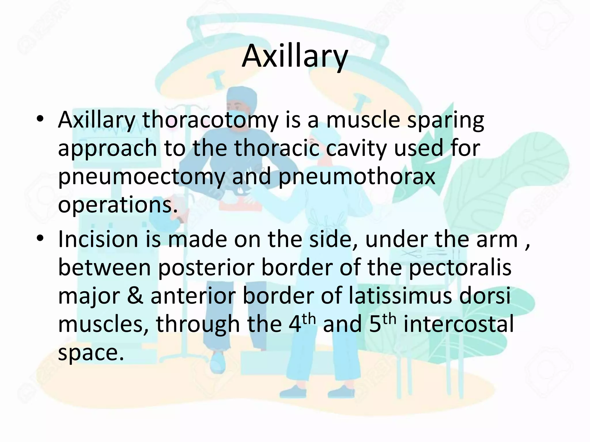 Thoracotomy | PPTX
