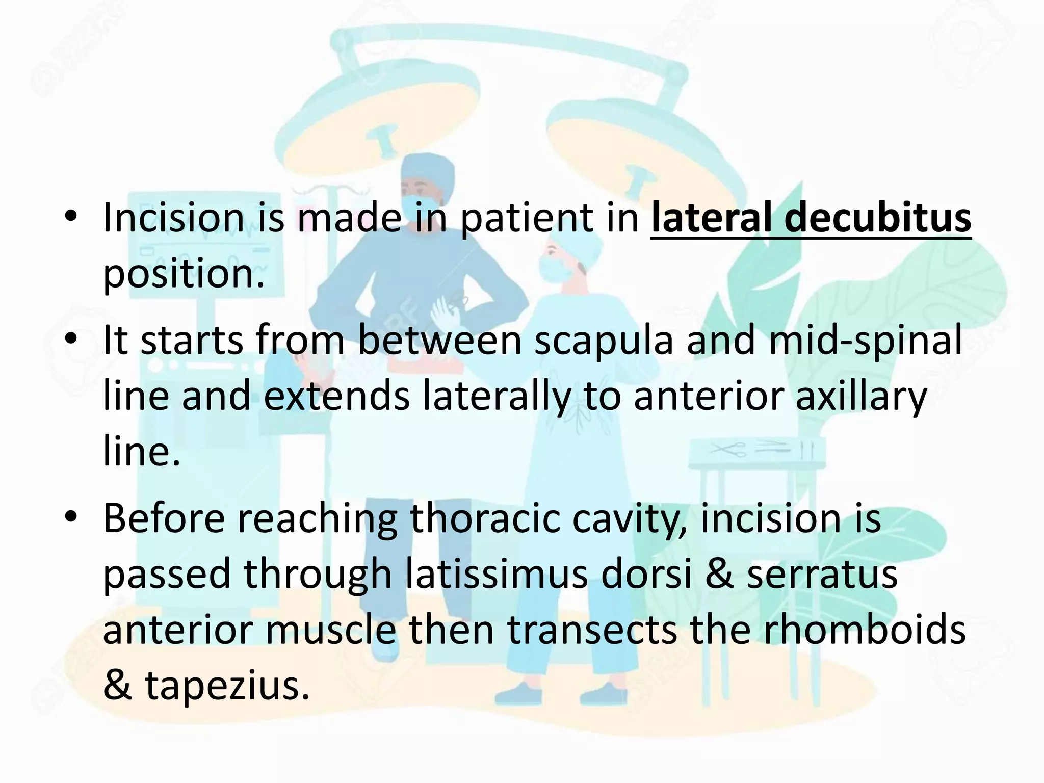 Thoracotomy | PPTX