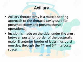 Thoracotomy | PPTX