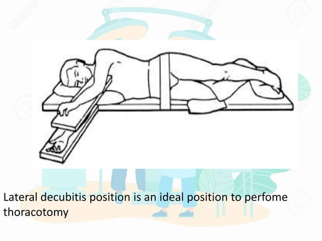Thoracotomy | PPTX
