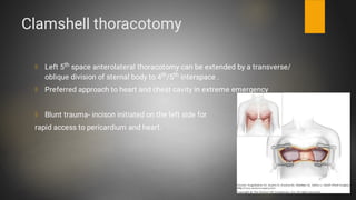 THORACOTOMY..............................pdf