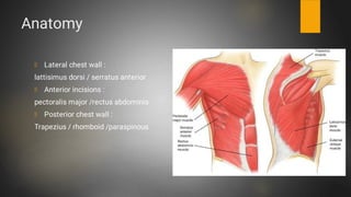 THORACOTOMY..............................pdf