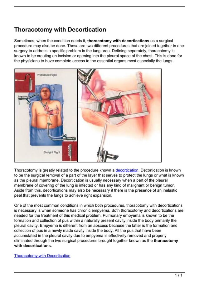 Thoracotomy with Decortication | PDF
