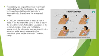 Thoracotomy and Sternotomy in Cardiac Surgery.pptx