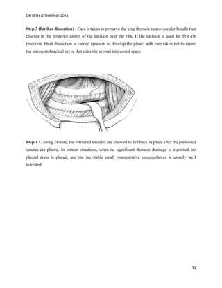 THORACOTOMY . SURGICAL PERSPECTIVES VOL 1 | PDF