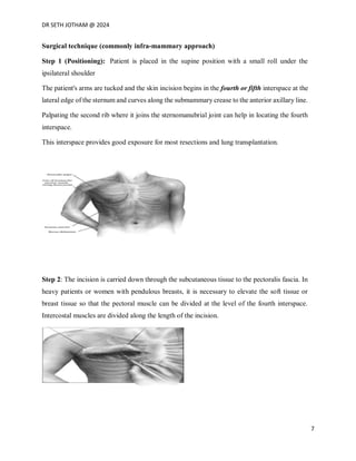 THORACOTOMY . SURGICAL PERSPECTIVES VOL 1 | PDF