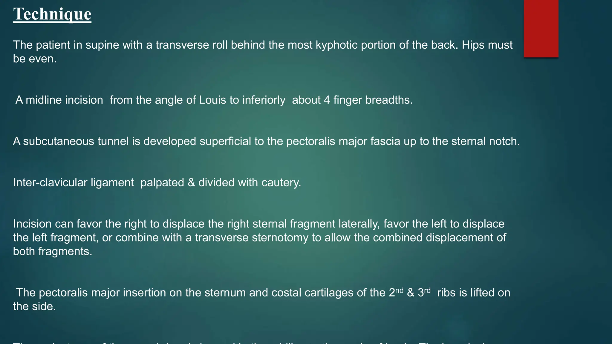 THORACOTOMY INCISION ppt by Dr. Amrit kumar | PPTX