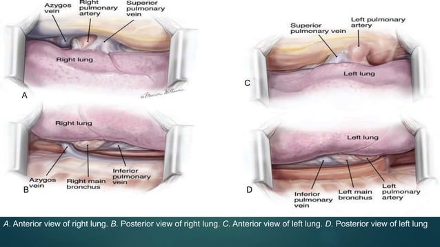THORACOTOMY INCISION ppt by Dr. Amrit kumar | PPTX | Death, Injury, or ...