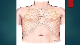 THORACOTOMY INCISION ppt by Dr. Amrit kumar | PPTX