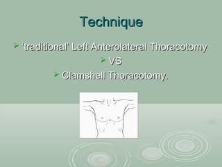 Emergency Thoracotomy | PPT