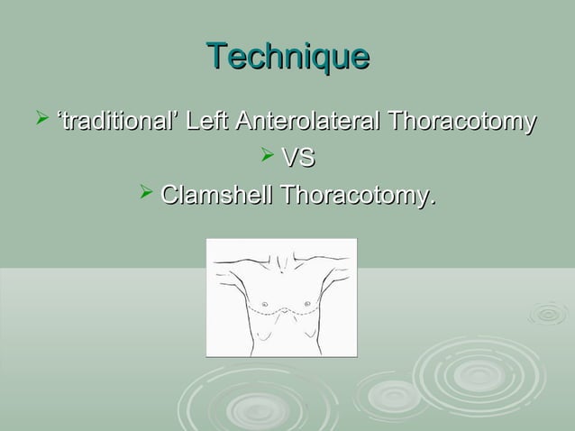 Emergency Thoracotomy | PPT
