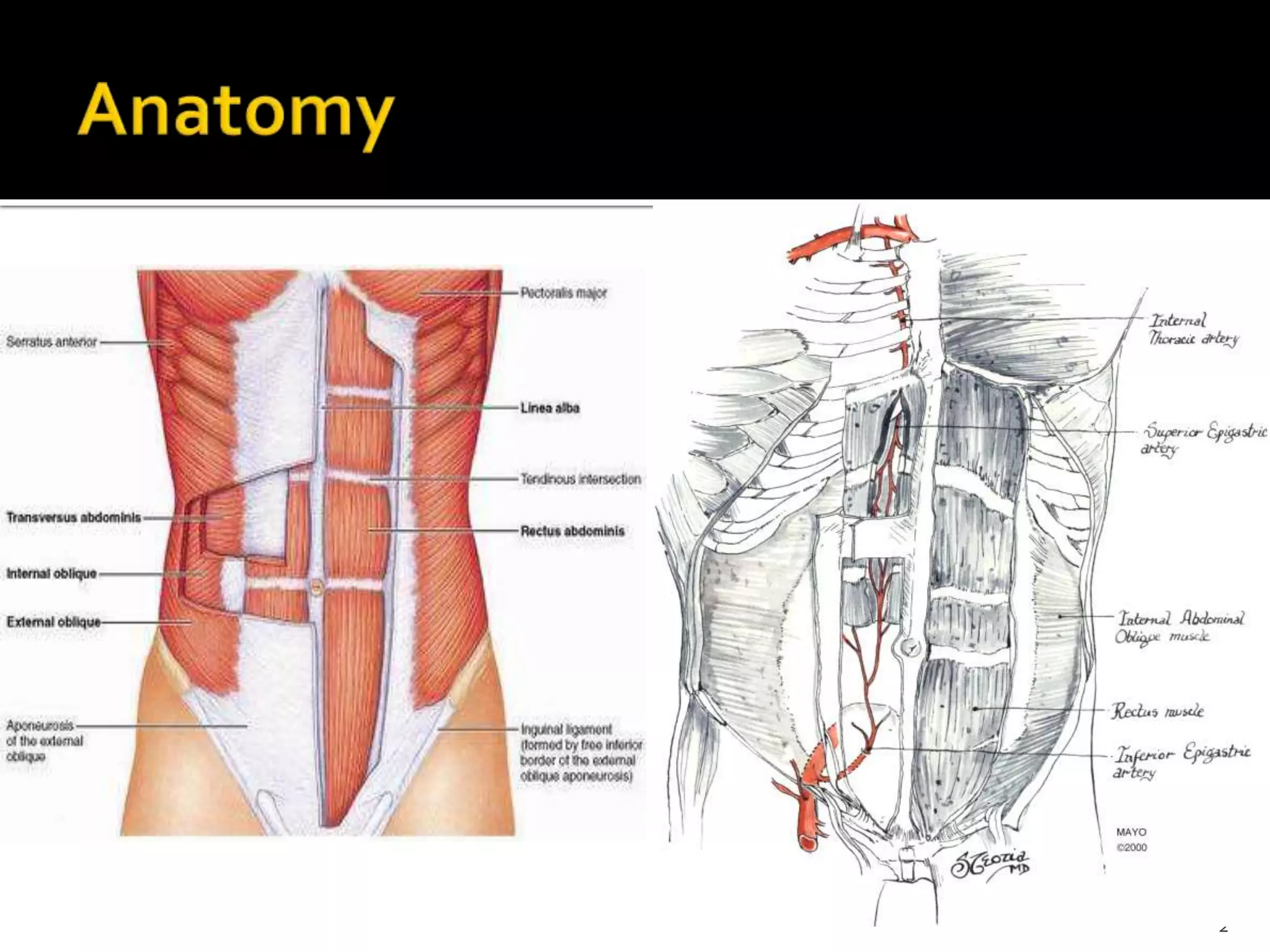 THORACOUMBILICAL FLAP DR VIPIN V NAIR | PPTX