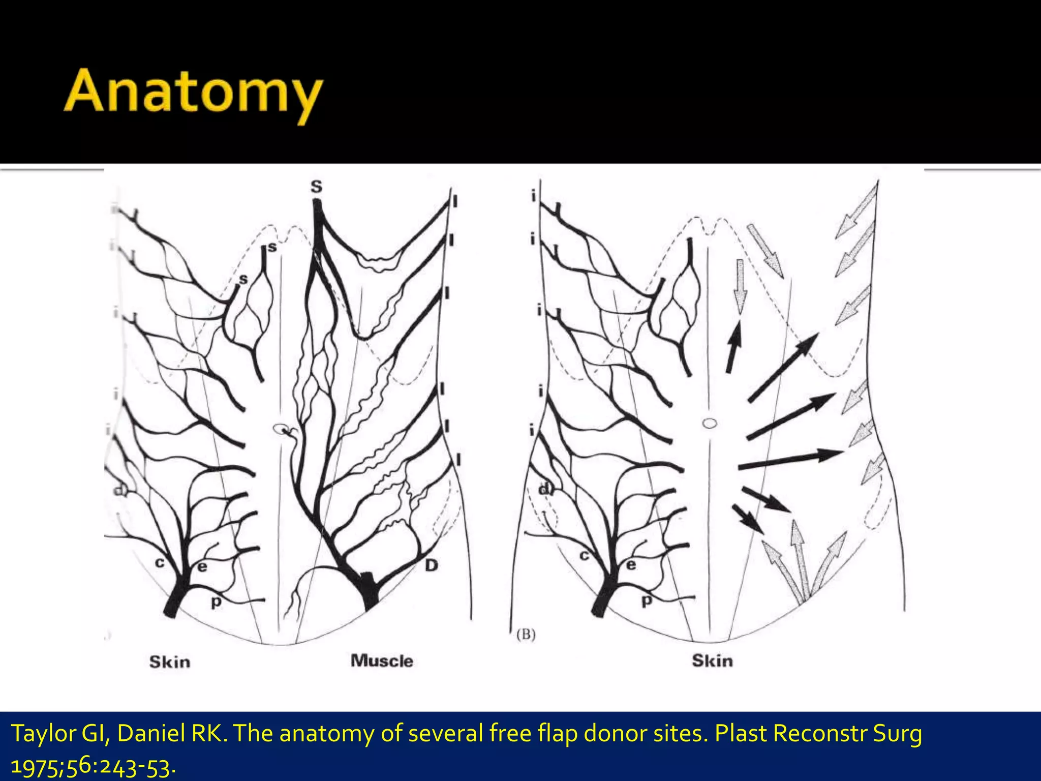 THORACOUMBILICAL FLAP DR VIPIN V NAIR | PPTX