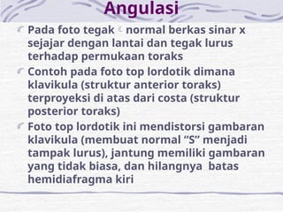Thoraks Normal, PPT yang di buat oleh coass untuk dapat di baca mudah ...