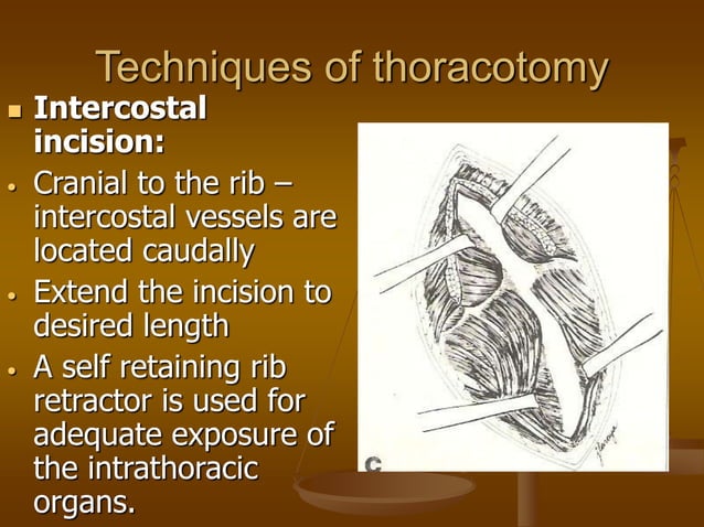 Thoracic Surgery | PPT