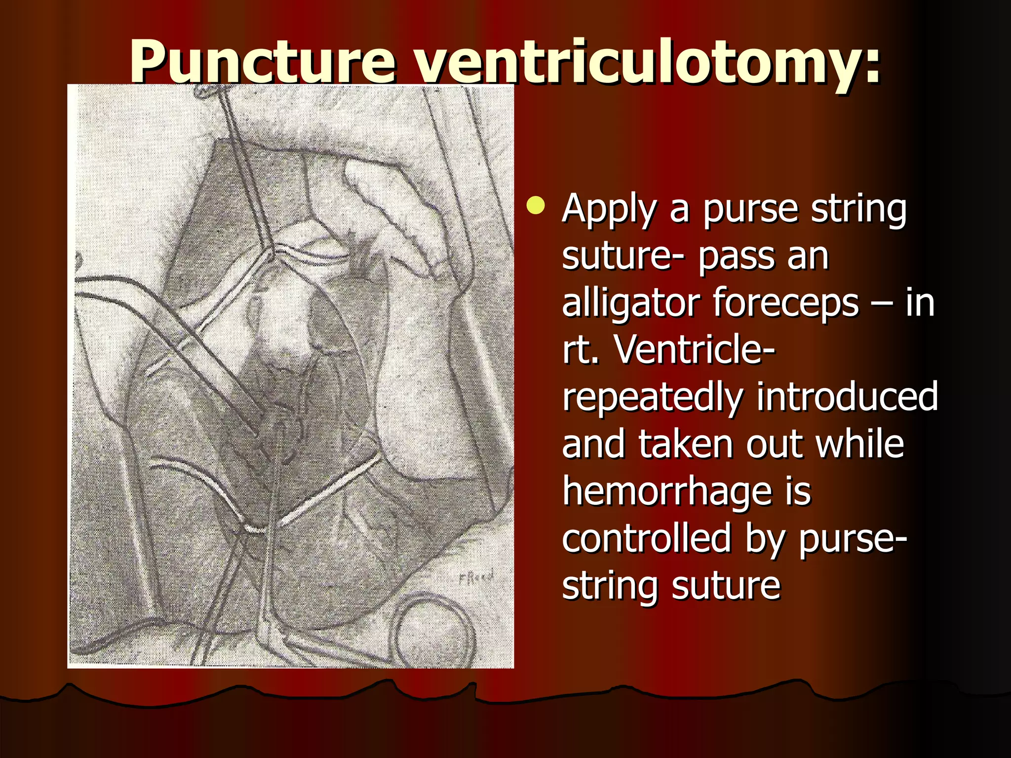 Thorax | PPT