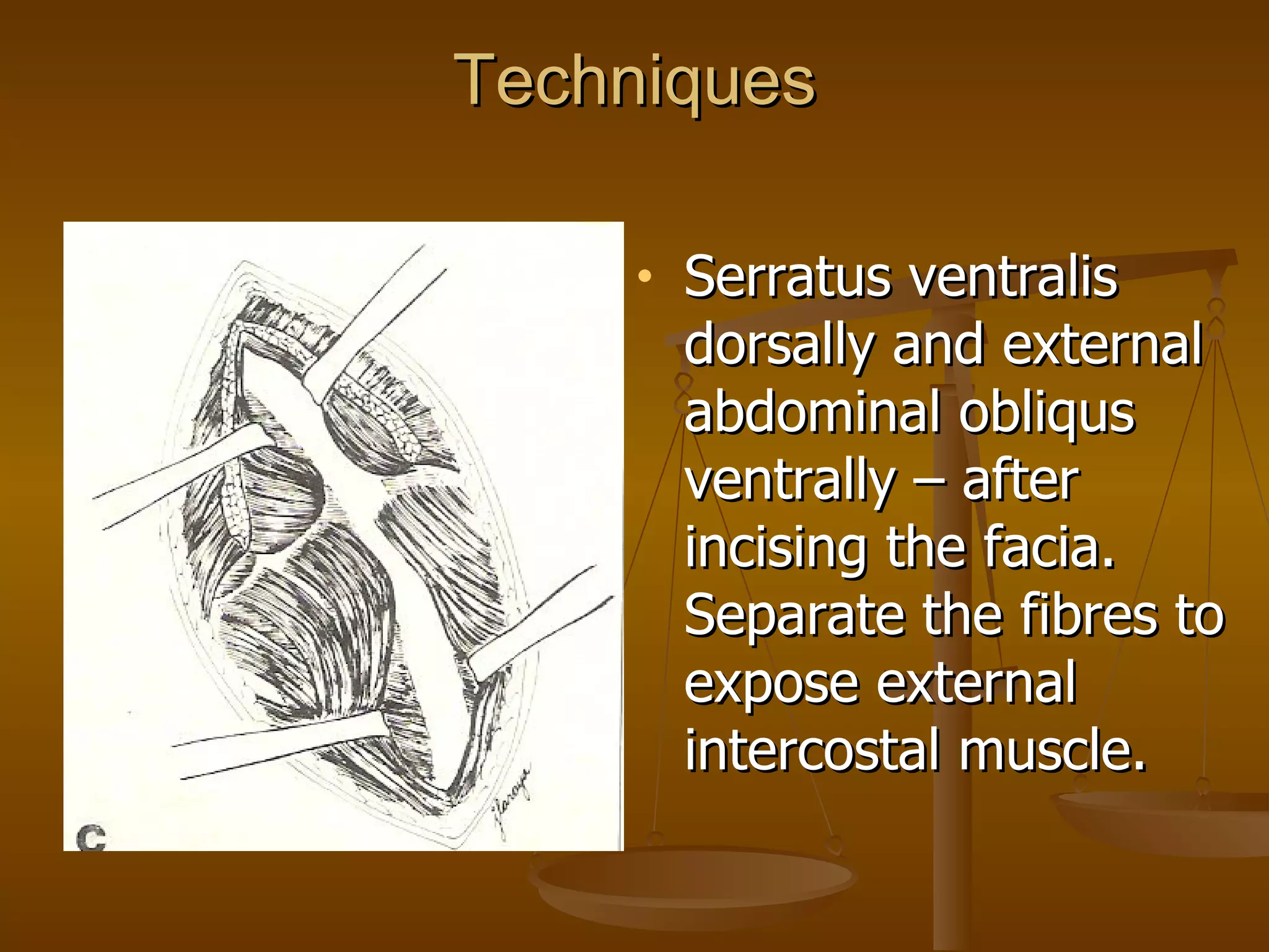 Thorax | PPT