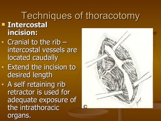 Thorax | PPT
