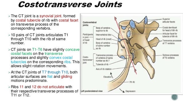 Costovertebral Joint Xray