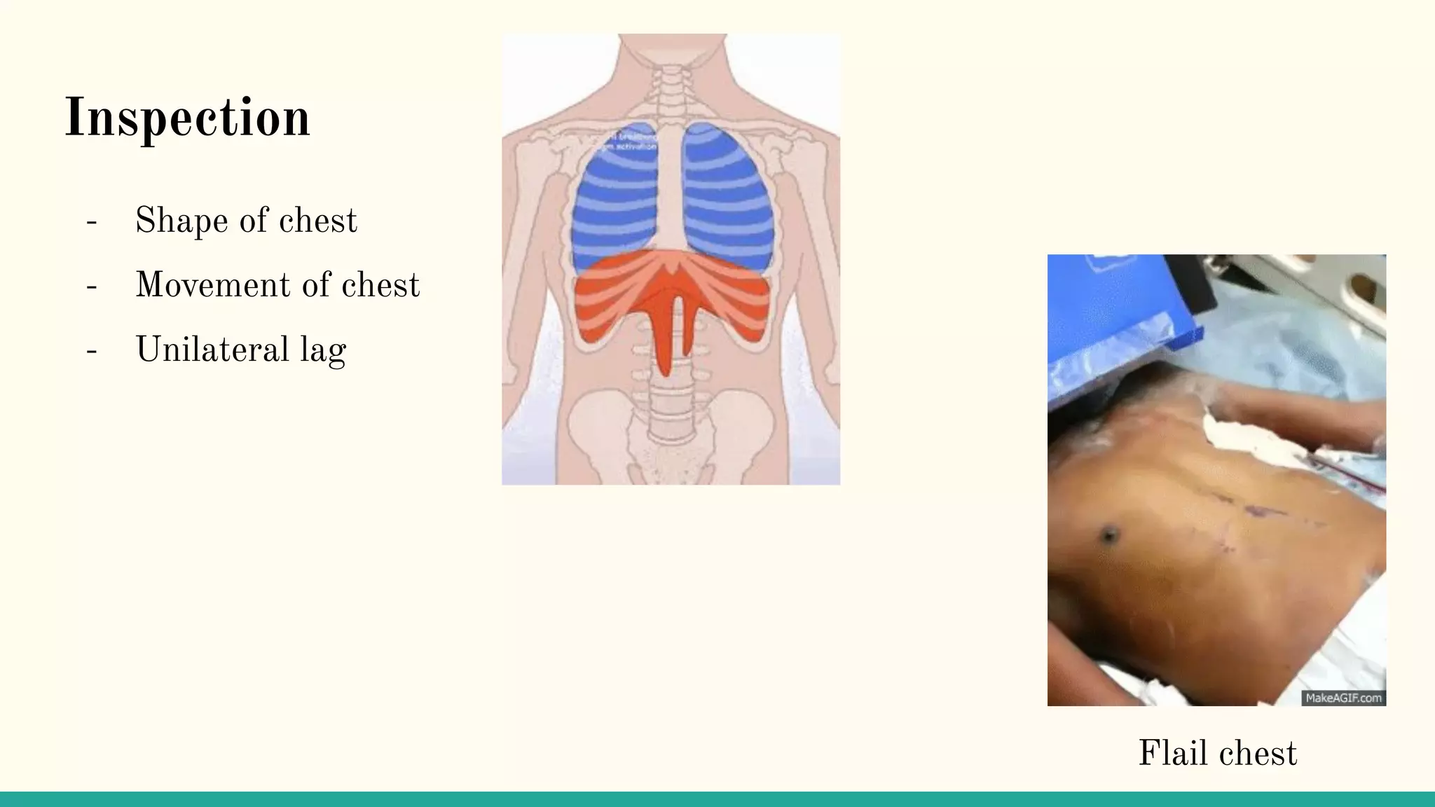 Physical Examination of Thorax | PDF