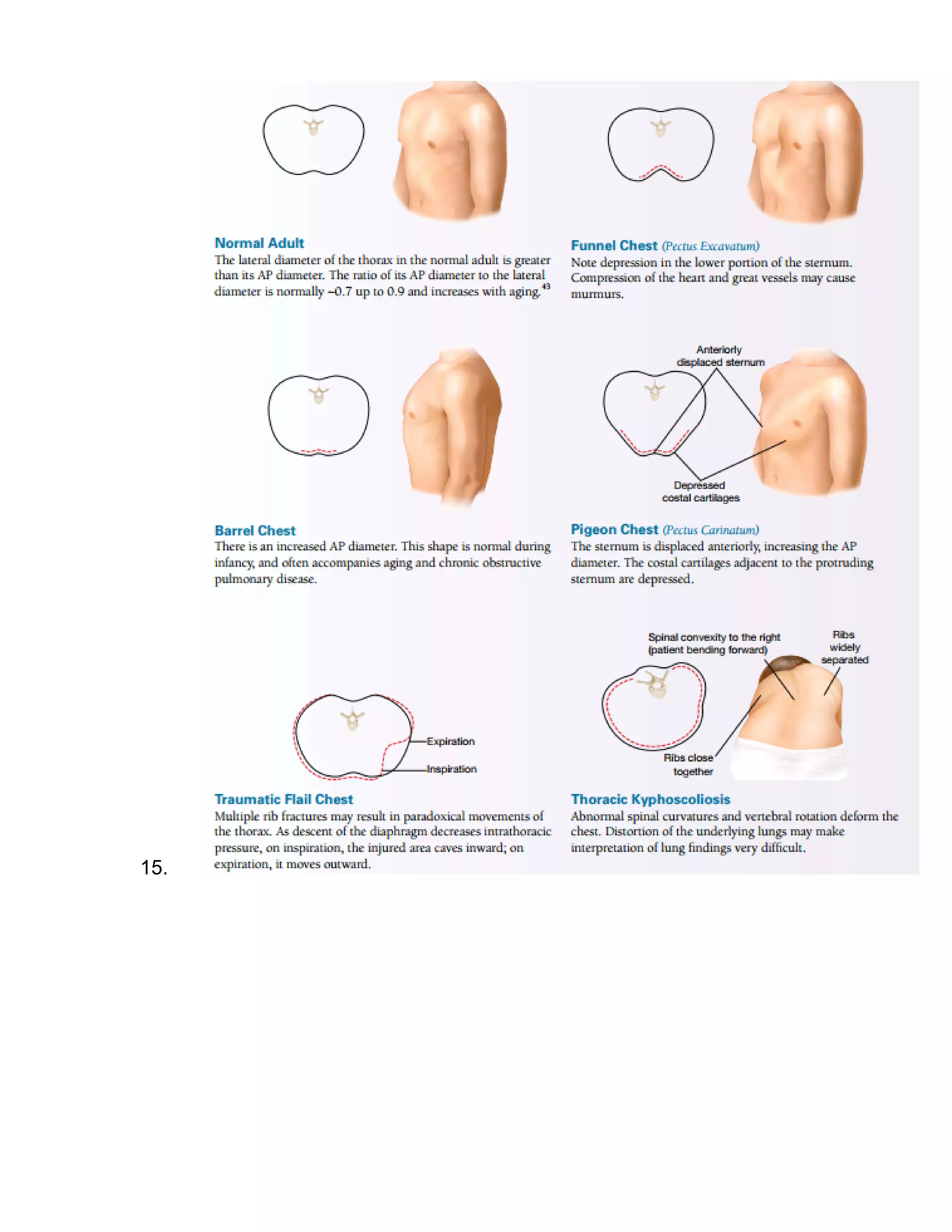 Physical Examination of Thorax | PDF