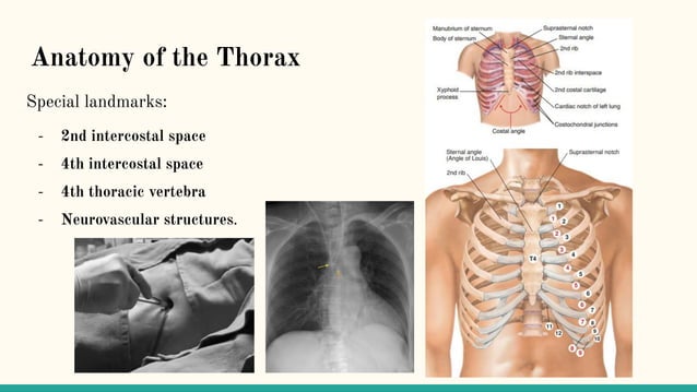 Physical Examination of Thorax | PPT