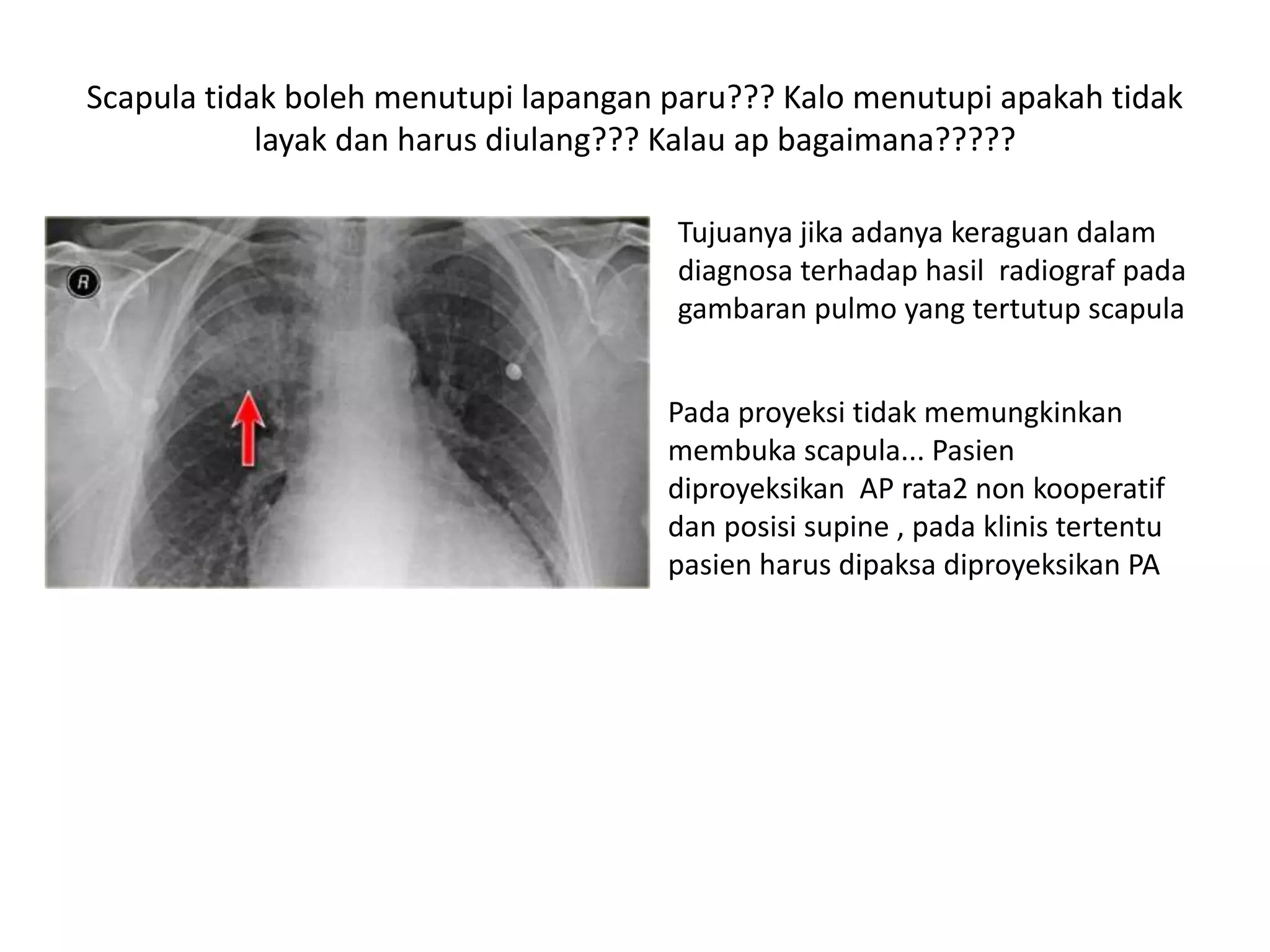THORAX.pptx
