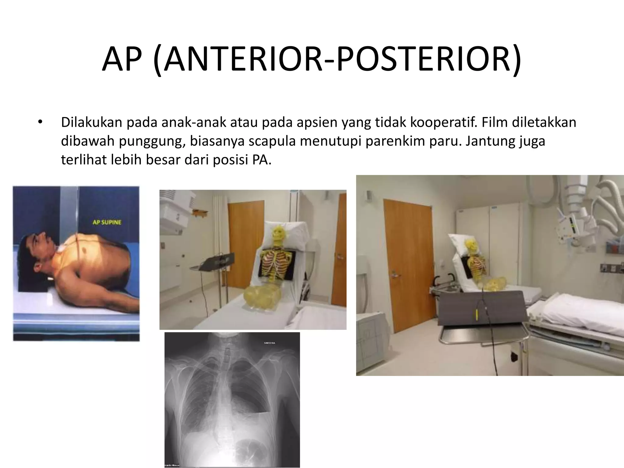 THORAX.pptx