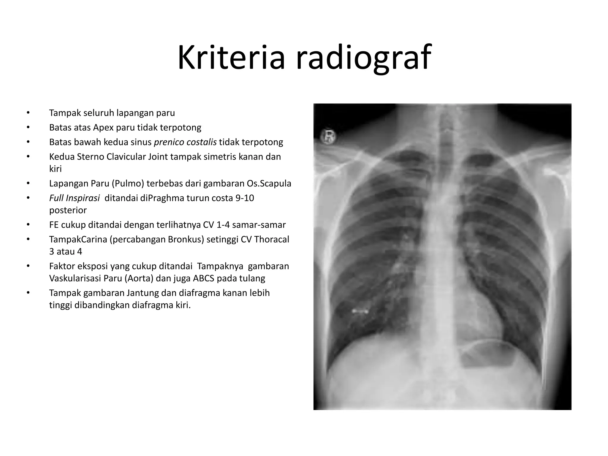 THORAX.pptx